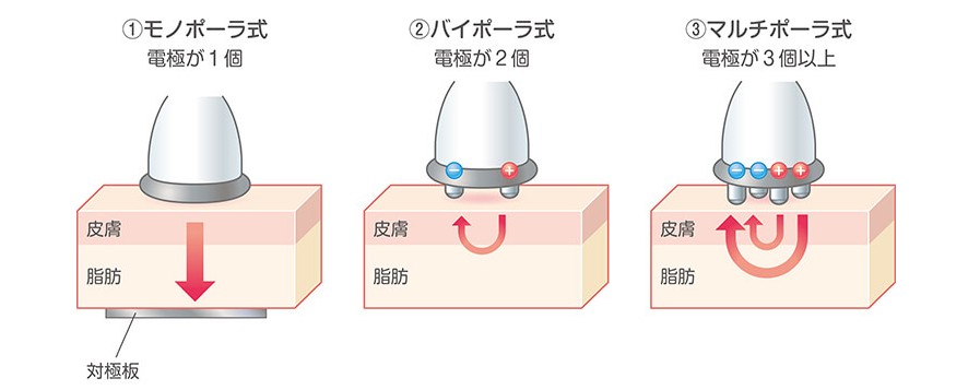 【科学的根拠あり】本当に効果のある美容医療を徹底解説 ～シワ・たるみ編～ | Beauty Science News
